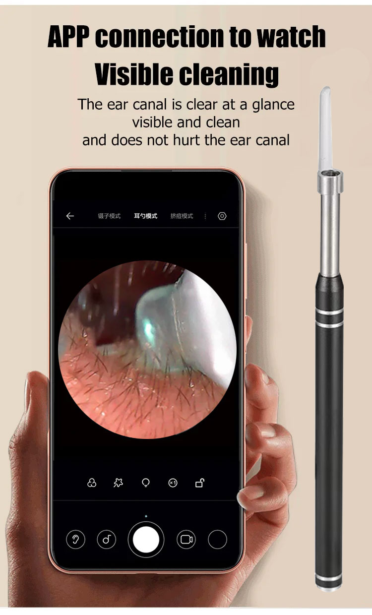 Wifi Smart Visual Ear Cleaner