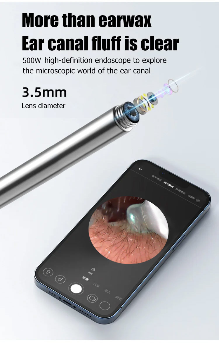 Wifi Smart Visual Ear Cleaner