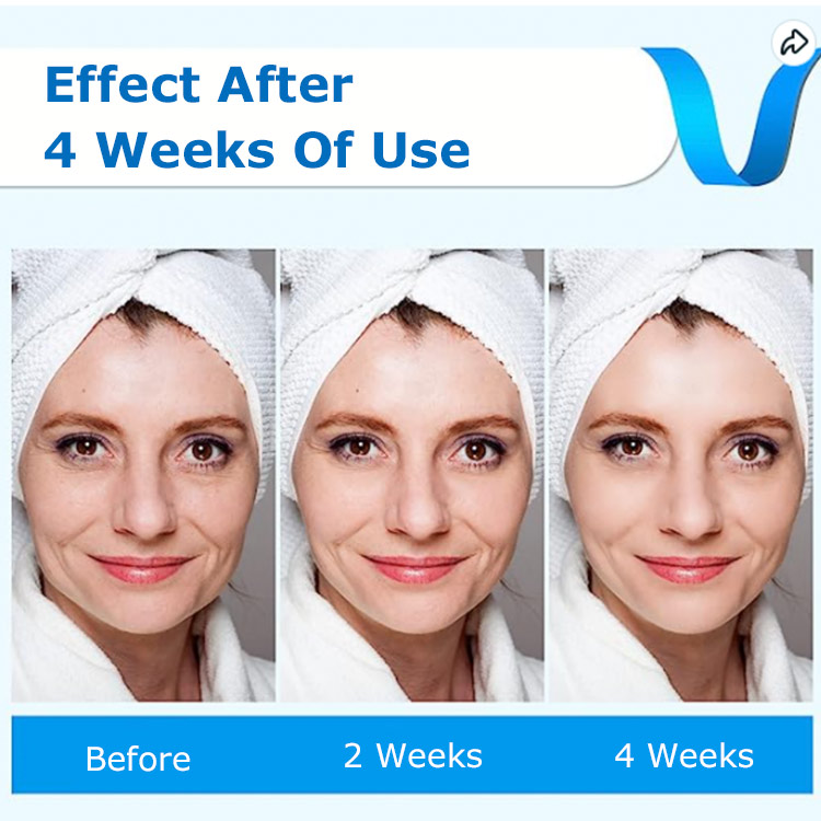 V-Face Lifting Device-EMS Massage Double Chin V-shaped Face Slimming